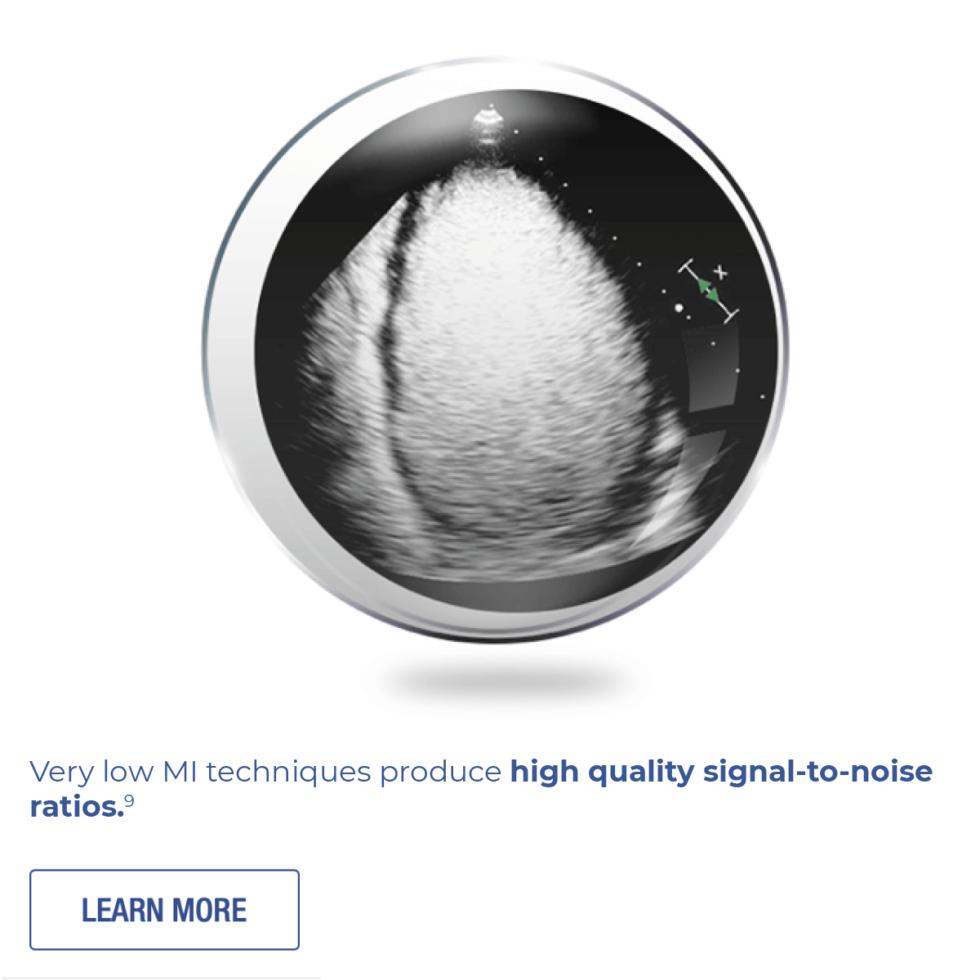 Ultrasound Enhancing Agent - LUMASON