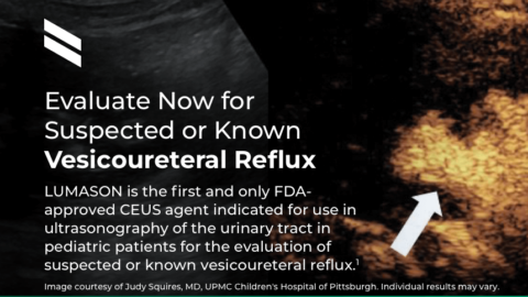 Urinary Tract - LUMASON