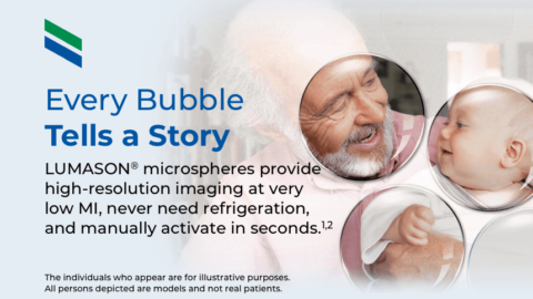 LUMASON Home Page - LUMASON