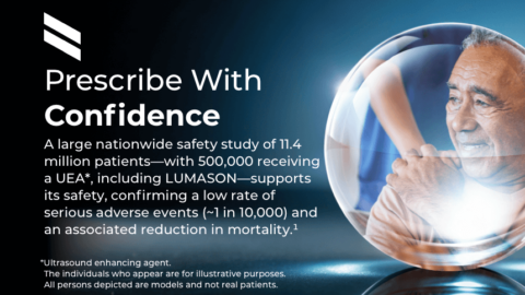 LUMASON Home Page - LUMASON